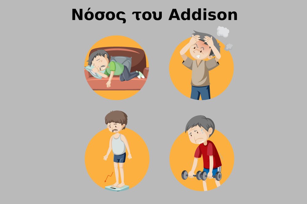 Νόσος του Addison: Συμπτώματα, Αιτίες και Θεραπεία