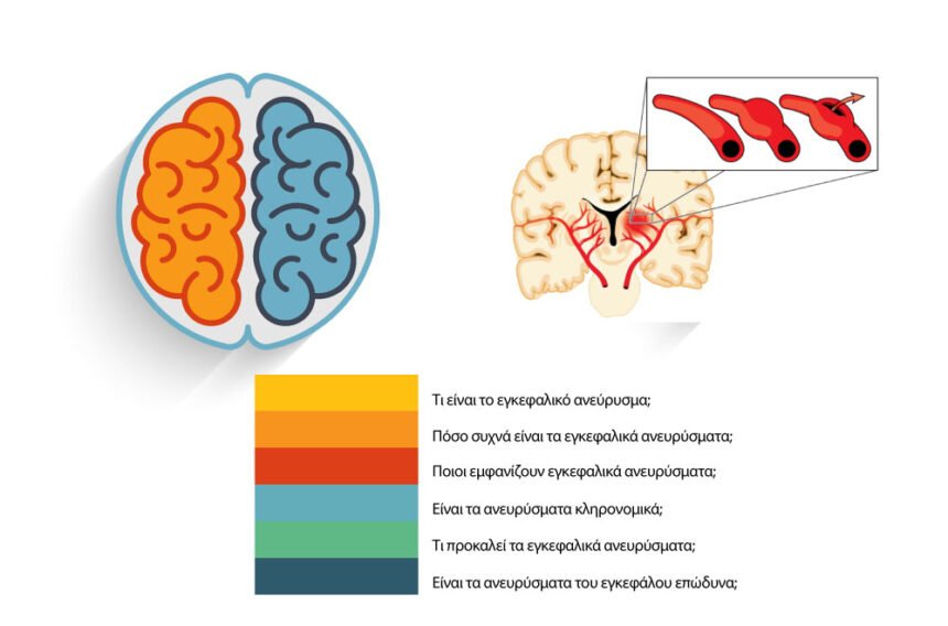 Ανεύρυσμα Εγκεφάλου: Κίνδυνοι, Συμπτώματα και Θεραπεία